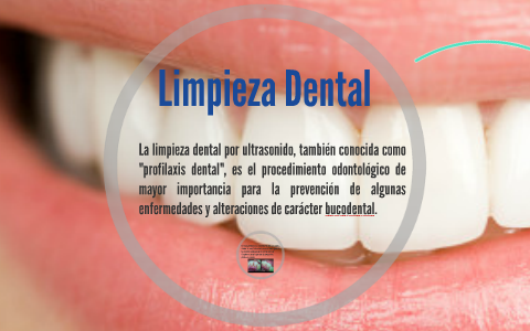 CAVITRON by Arturo Muñoz on Prezi