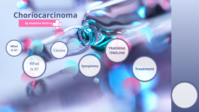Choriocarcinoma By Madeline Mcelroy On Prezi