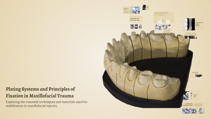 Plating Systems and Principles of Fixation in Maxillofacial Trauma by ...