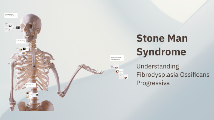 Stone Man Syndrome by Aloisia Bennett on Prezi