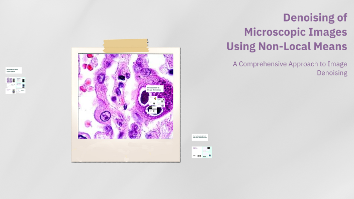 Denoising of Microscopic Images Using Non-Local Means by Buvana Sri N ...
