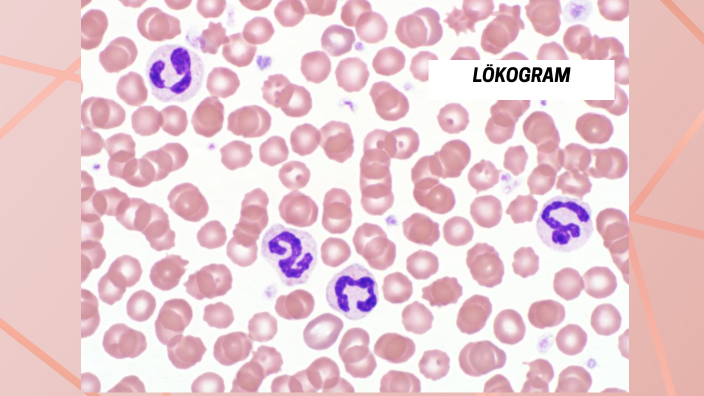 LEUKOGRAM by Cansu KILICKAYA on Prezi