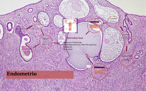 Endometrio by on Prezi