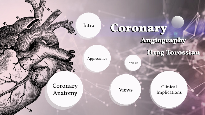 Coronary Angiography by Hrag Torossian on Prezi
