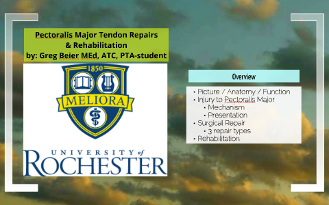 Pectoralis Major Tendon Repairs and Rehabilitation by Greg Beier on Prezi