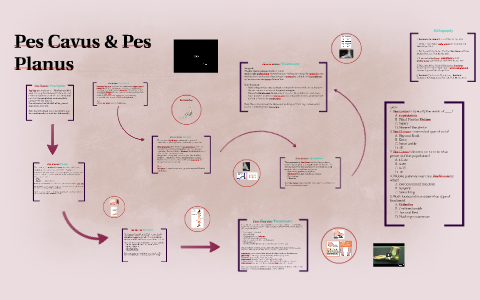 Pes Cavus by Jess Patterson on Prezi