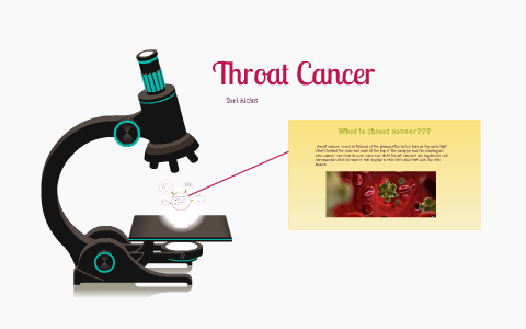 Throat Cancer by tori hicks on Prezi
