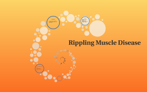 Rippling Muscle Disease by Kenzie Meyerson on Prezi