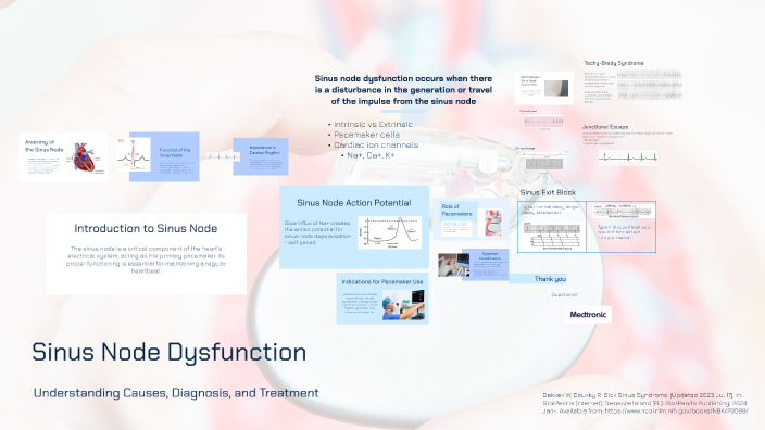 Sinus Node Dysfunction by Jessica Tattersall on Prezi