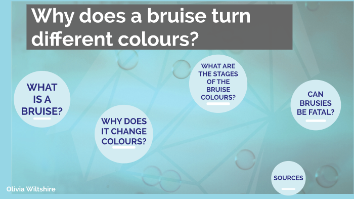 Why does a bruise turn colours? by Olivia Wiltshire on Prezi