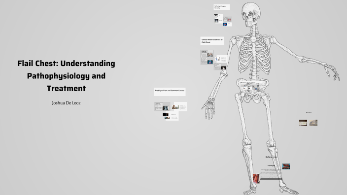 Flail Chest: Understanding Pathophysiology and Treatment by Josh Deleoz ...