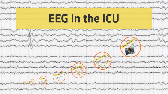 EEG in the ICU by Doug Rae on Prezi