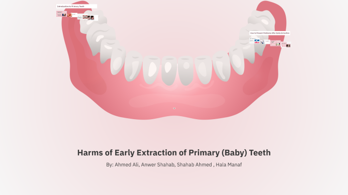 Harms of Early Extraction of Primary (Baby) Teeth by ahmed ali on Prezi