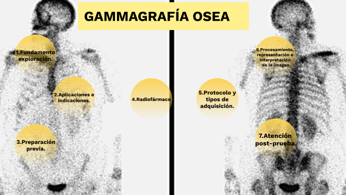 GAMMAGRAFÍA OSEA by Aroa Pastor on Prezi