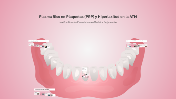 Plasma Rico en Plaquetas (PRP) y Hiperlaxitud en la ATM by Stephany ...