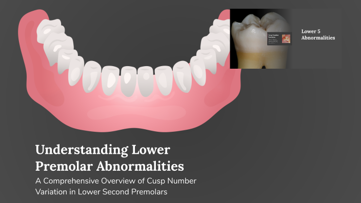 Understanding Lower Premolar Abnormalities by Ahmed Gad on Prezi