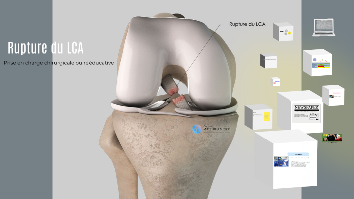 Rupture du LCA by Genevieve Parent on Prezi