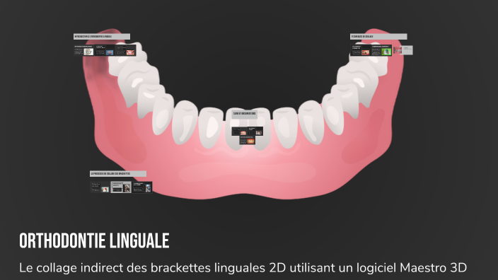 Orthodontie linguale by orthodontica lab on Prezi
