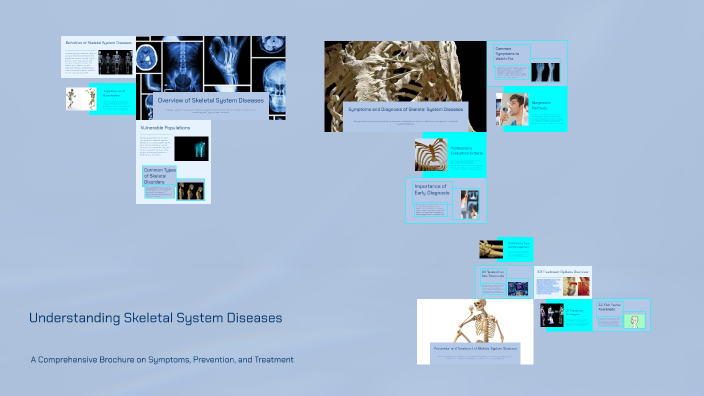 Understanding Skeletal System Diseases by curtis ho on Prezi