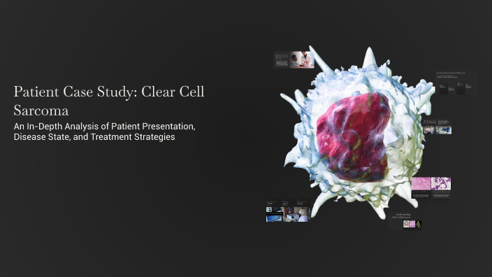 Patient Case Study: Clear Cell Sarcoma by Saibriyya Pou on Prezi