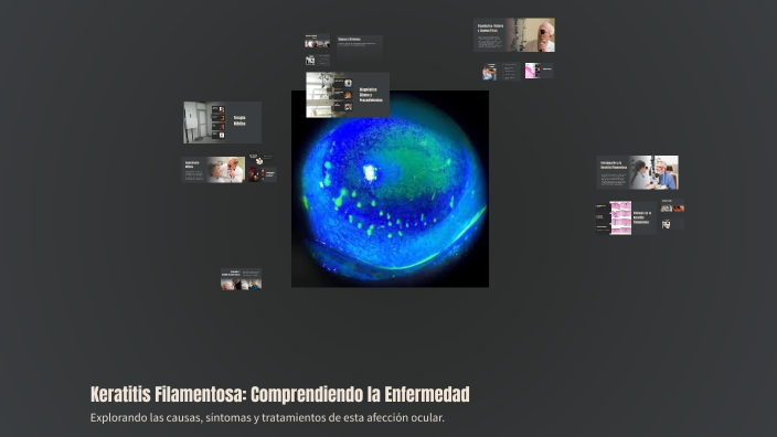 Keratitis Filamentosa: Comprendiendo la Enfermedad by Sabrina Lunasco ...