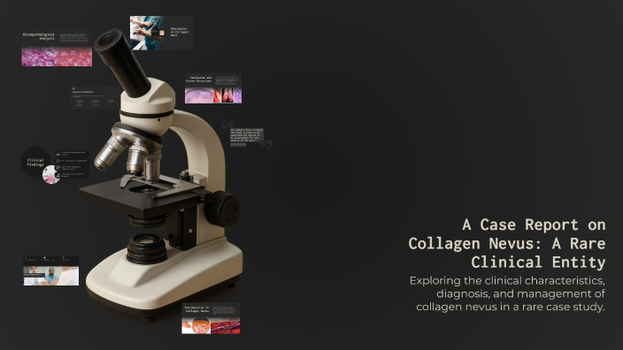 A Case Report on Collagen Nevus: A Rare Clinical Entity by bilal safa ...