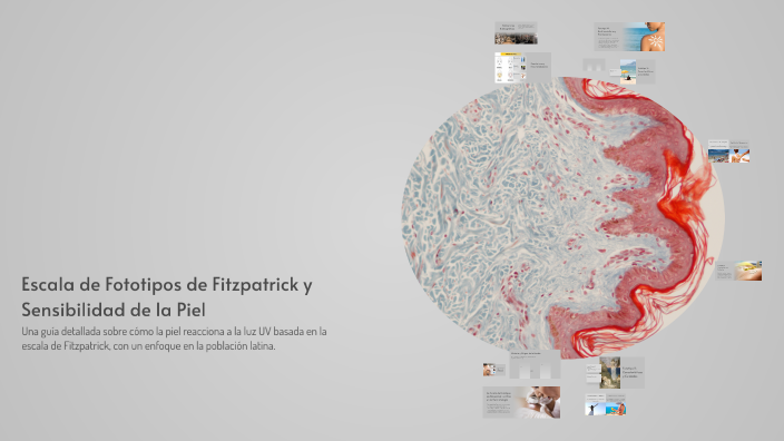 Escala de Fototipos de Fitzpatrick y Sensibilidad de la Piel by Maria ...