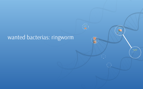 wanted bacterias: ringworm by gladiatorjaylon golden on Prezi