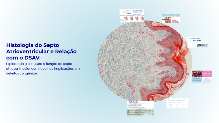 Histologia do Septo Atrioventricular e Relação com o DSAV by Gusta on Prezi
