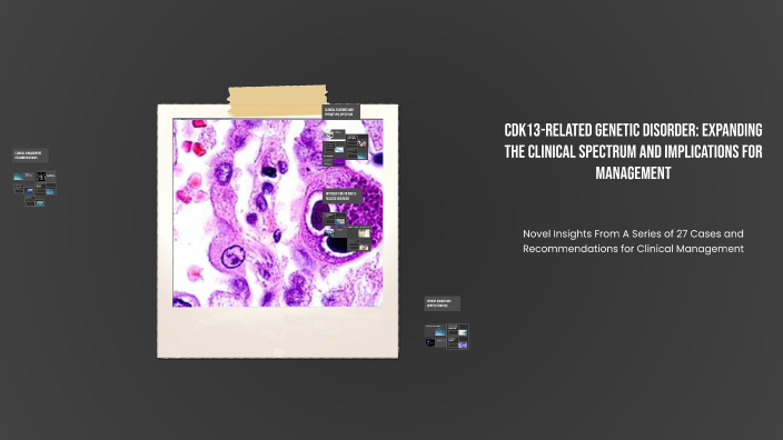 CDK13-Related Genetic Disorder: Expanding the Clinical Spectrum and ...