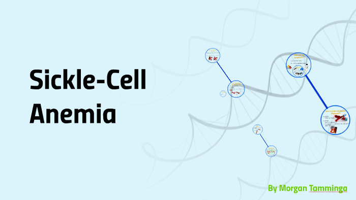 Sickle-Cell Anemia by richard tamminga