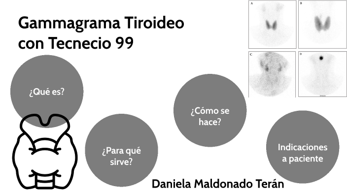 Gammagrama Tiroideo con Tecnecio 99 B by DANIELA MALDONADO TERÁN on Prezi