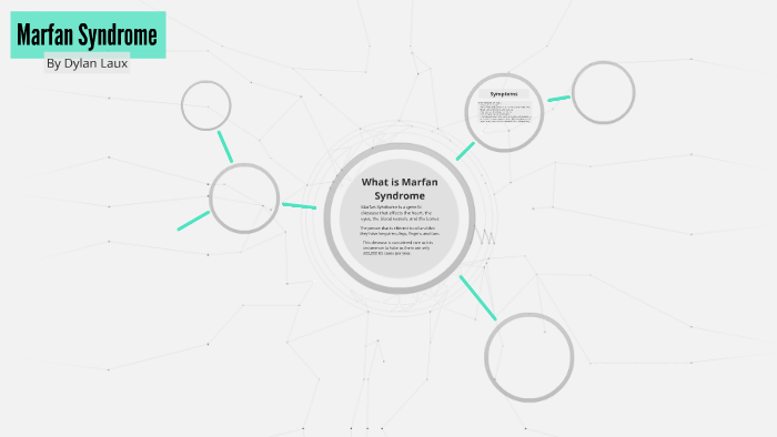 Marfan Syndrome by Dylan Laux on Prezi
