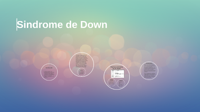 Rehabilitación de Sindrome de Down by Christian Castelan Castro on Prezi
