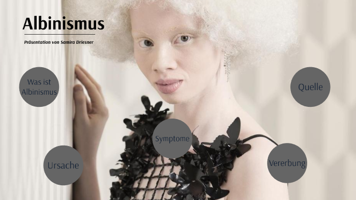Alles Ber Menschen Mit Albinismus Besser Gesund Leben