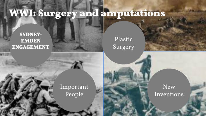 WWI: Surgery and amputation by Angel Reyes on Prezi