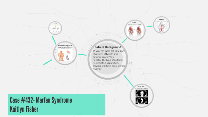 Case #432- Marfan Syndrome by Kaitlyn Fisher on Prezi