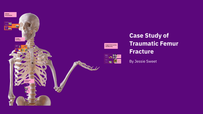 Case Study of Traumatic Femur Fracture by Jessie Sweet on Prezi