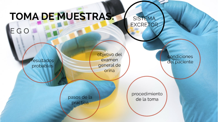 TOMA DE MUESTRAS: EGO by jorge alamilla on Prezi
