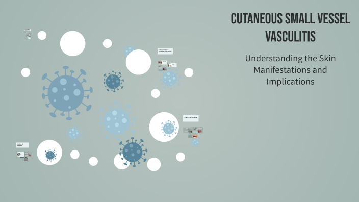 Cutaneous Small Vessel Vasculitis by Eisa Hegazy on Prezi