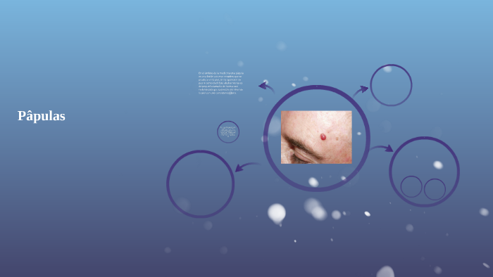 En el ámbito de la medicina una pápula es una lesión o tumor by Johanna ...