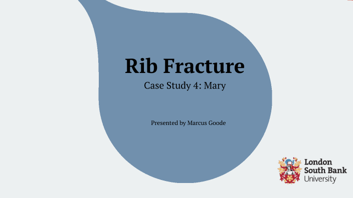 rib fracture by Marcus Goode on Prezi
