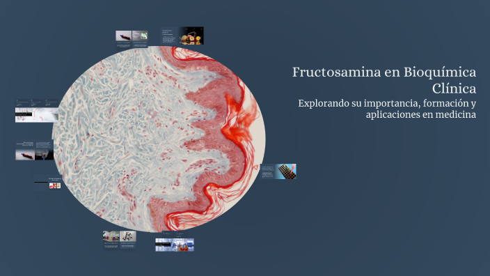 Fructosamina en Bioquímica Clínica by Lexi CR on Prezi