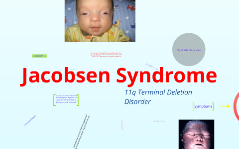 Jacobsen Syndrome by Jonathan Chiang