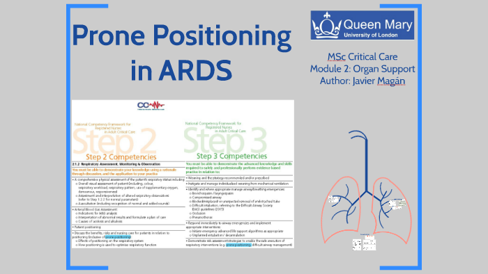 Prone Positioning in ARDS by Javier Magan on Prezi