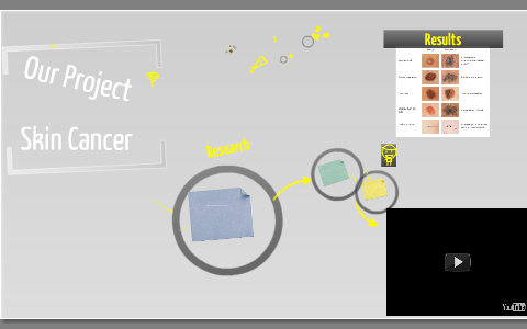Skin Cancer by zack melton on Prezi