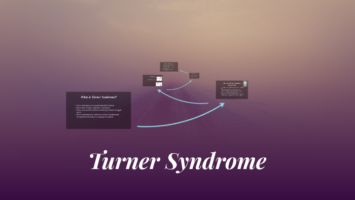 Turner Syndrome by Audrey Escoto on Prezi
