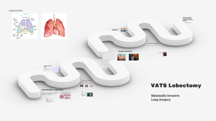 VATS Lobectomy by ana alcantar on Prezi