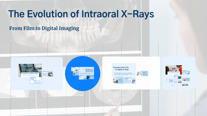 The Evolution of Intraoral X-Rays by Abdullah Alharbi on Prezi