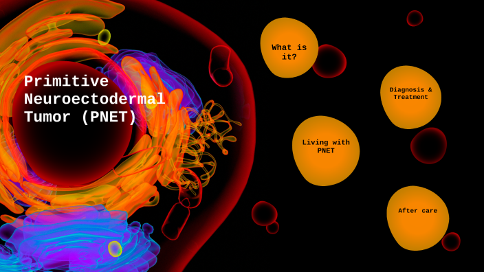 Primitive Neuroectodermal Tumors (PNET) by Valerie Jones on Prezi